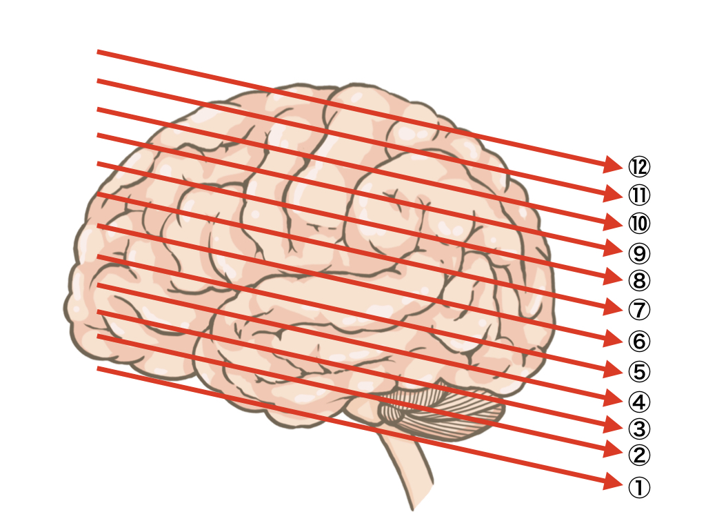 【実習】脳のMRI断面図！実際の画像を見て理解をしよう！