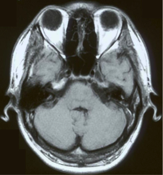 【実習】脳のMRI断面図！実際の画像を見て理解をしよう！